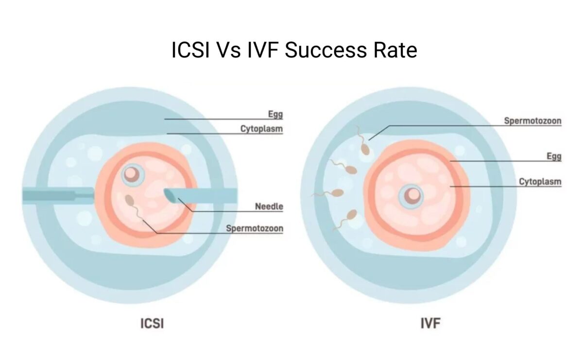 IVF Success Rate In First Attempt In 2026 - Increasing Success Rate